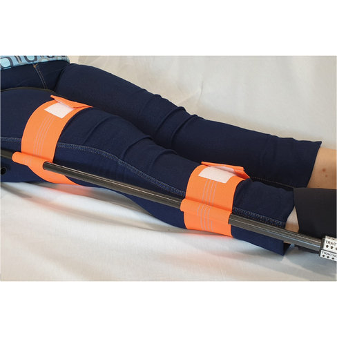 Attelle de traction CT7 dédiée aux milieux périlleux - version civile ...